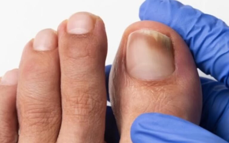 Diabetic Nail Care: 4 Vital Do's And Dont's To Know